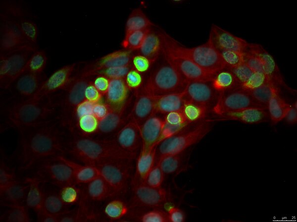 HCC95 Human Lung Squamous Carcinoma Cell Line | SCC483